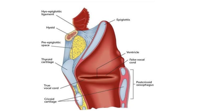 ca larynx continue (1) vrgrgefwdvferfq.pptx