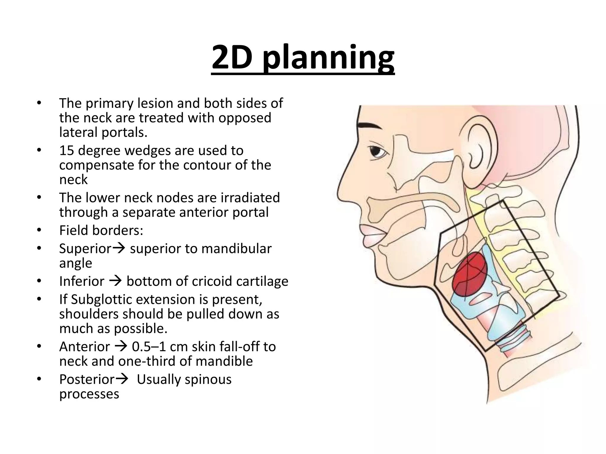 LARYNGEAL CANCER MANAGEMENT | PPTX | Ear, Nose and Throat Conditions | Diseases and Conditions