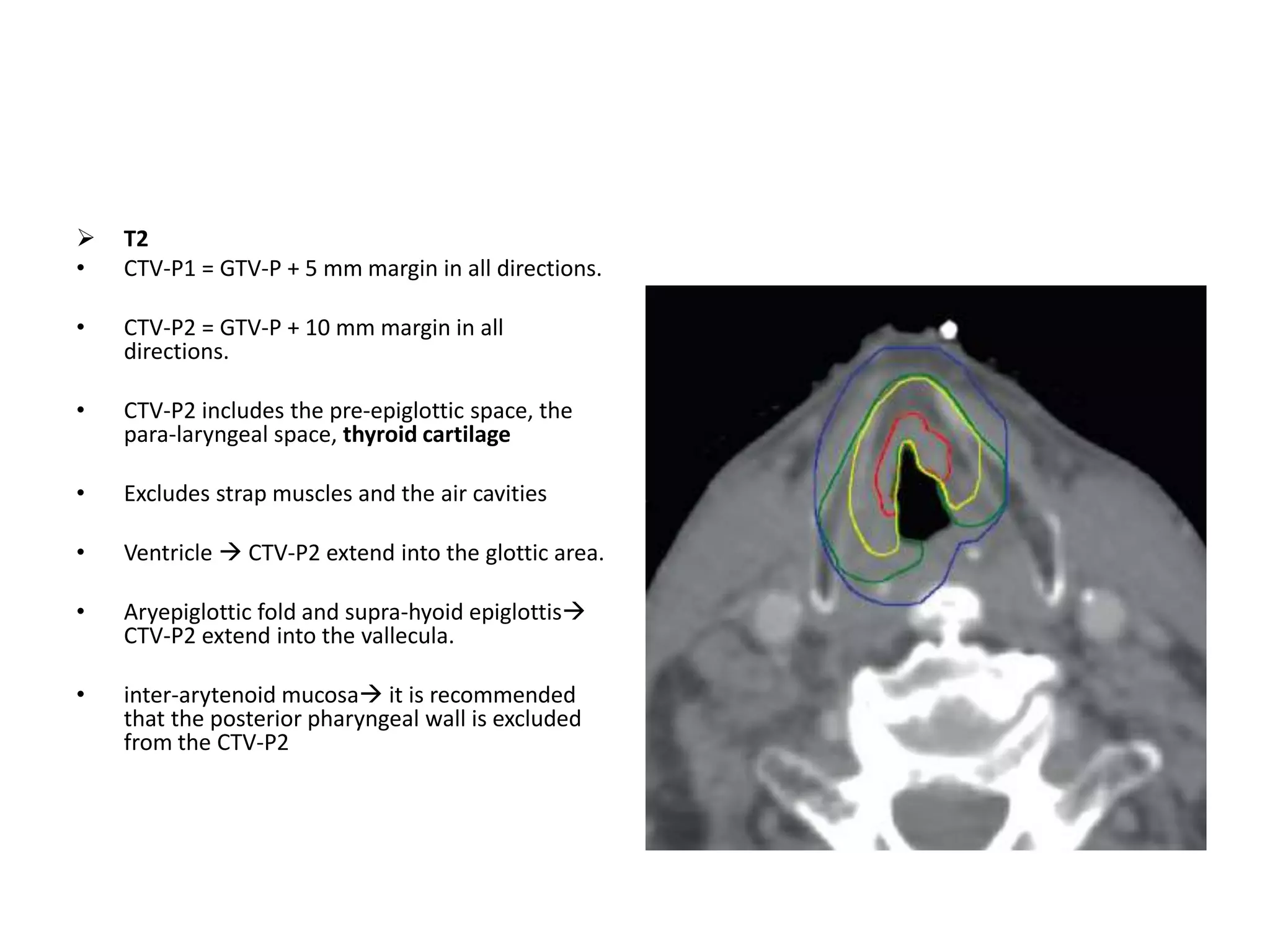 LARYNGEAL CANCER MANAGEMENT | PPTX | Ear, Nose and Throat Conditions | Diseases and Conditions