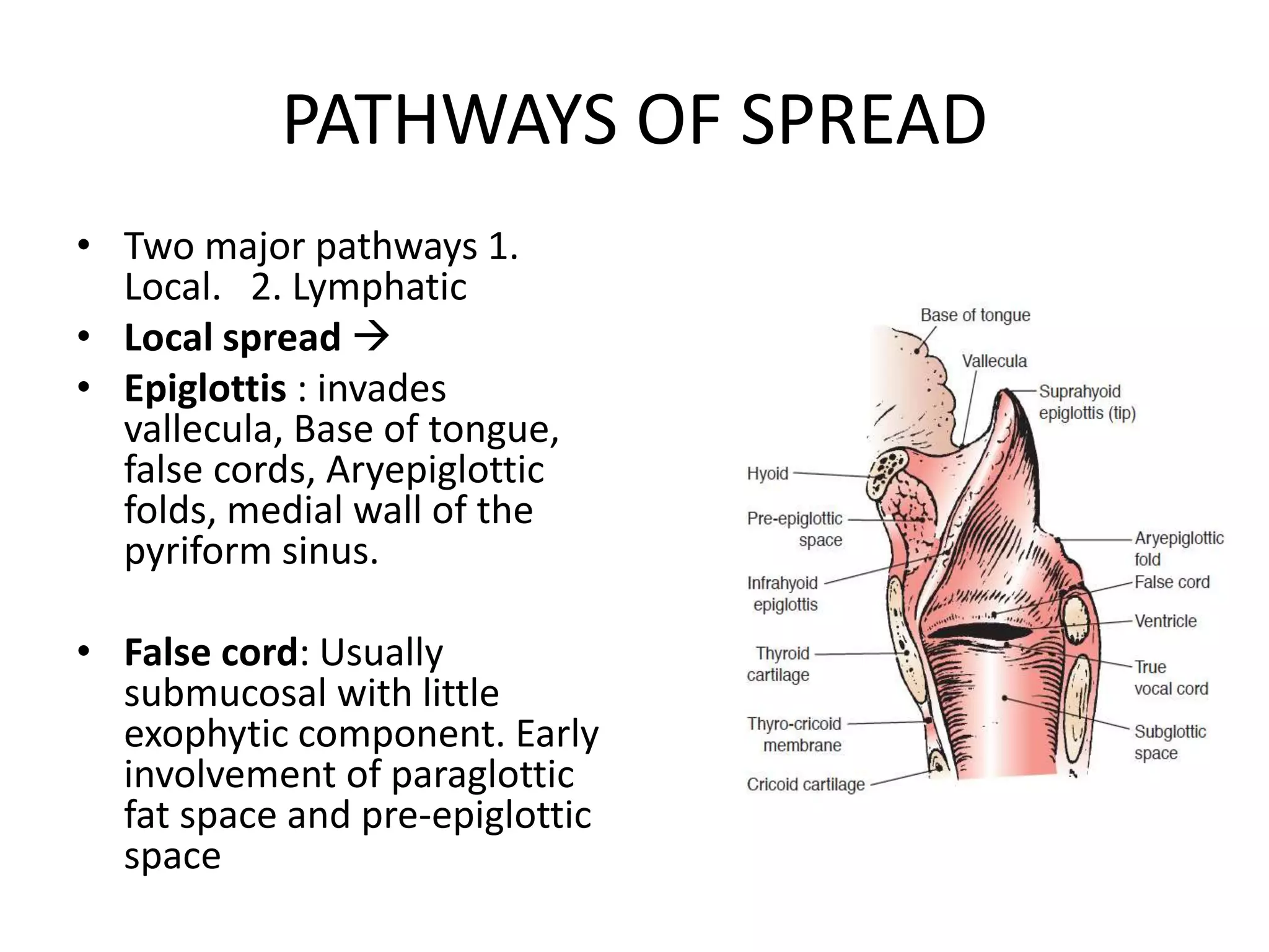 LARYNGEAL CANCER MANAGEMENT | PPTX