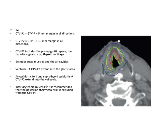 LARYNGEAL CANCER MANAGEMENT | PPTX | Ear, Nose and Throat Conditions | Diseases and Conditions
