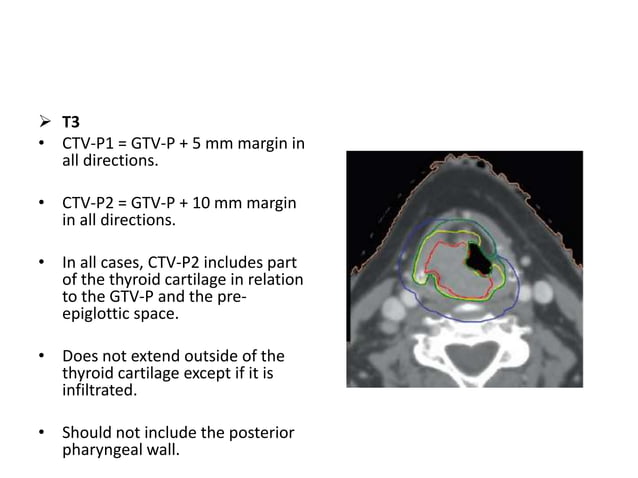 LARYNGEAL CANCER MANAGEMENT | PPTX | Ear, Nose and Throat Conditions | Diseases and Conditions