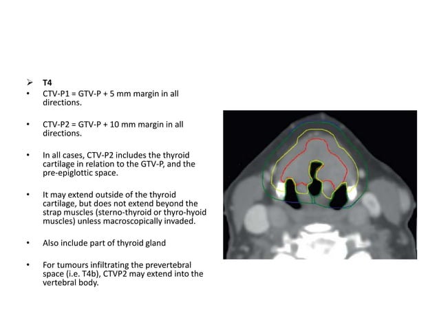 LARYNGEAL CANCER MANAGEMENT | PPTX | Ear, Nose and Throat Conditions | Diseases and Conditions