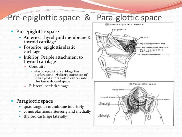 Carcinoma larynx- A wider perspective