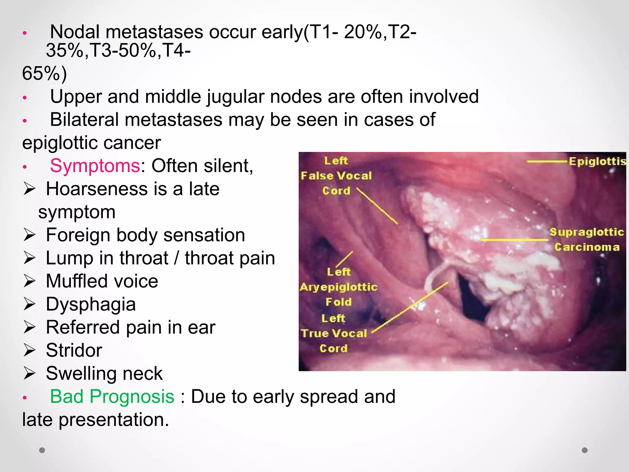 CA LARYNX | PPTX