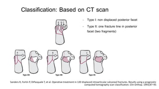 Calcaneal fracture | PDF