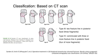 Calcaneal fracture | PDF
