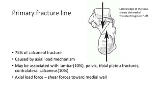 Calcaneal fracture 101 bedru mohammed15168tyr42.pptx