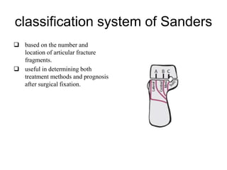 Calcaneal fractures | PPTX