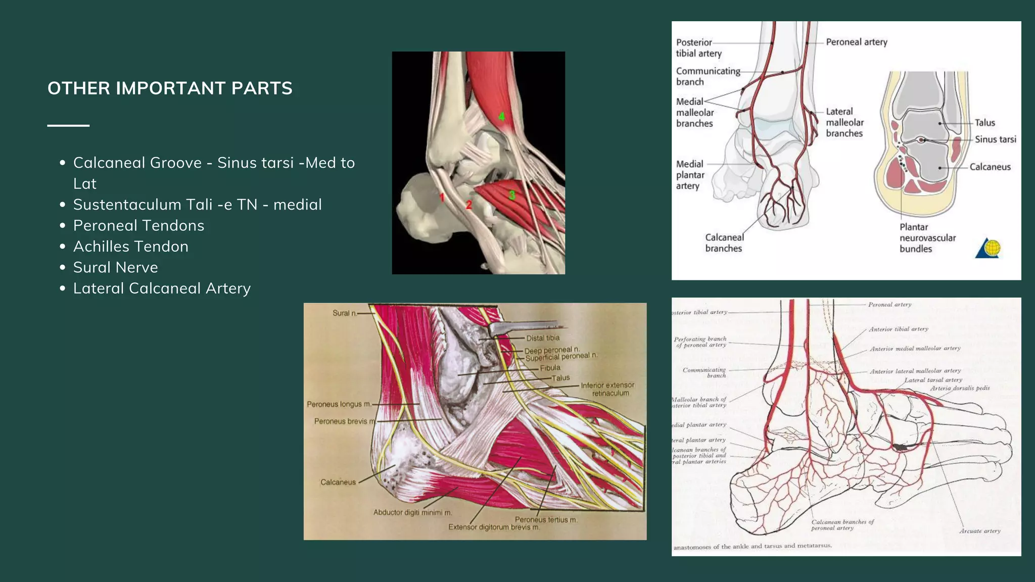 Malunited Calcaneus Fractures | PDF