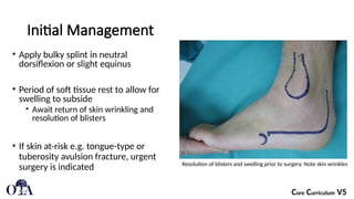 Approach to and Management of calcaneal fractures.pptx