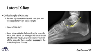 Approach to and Management of calcaneal fractures.pptx