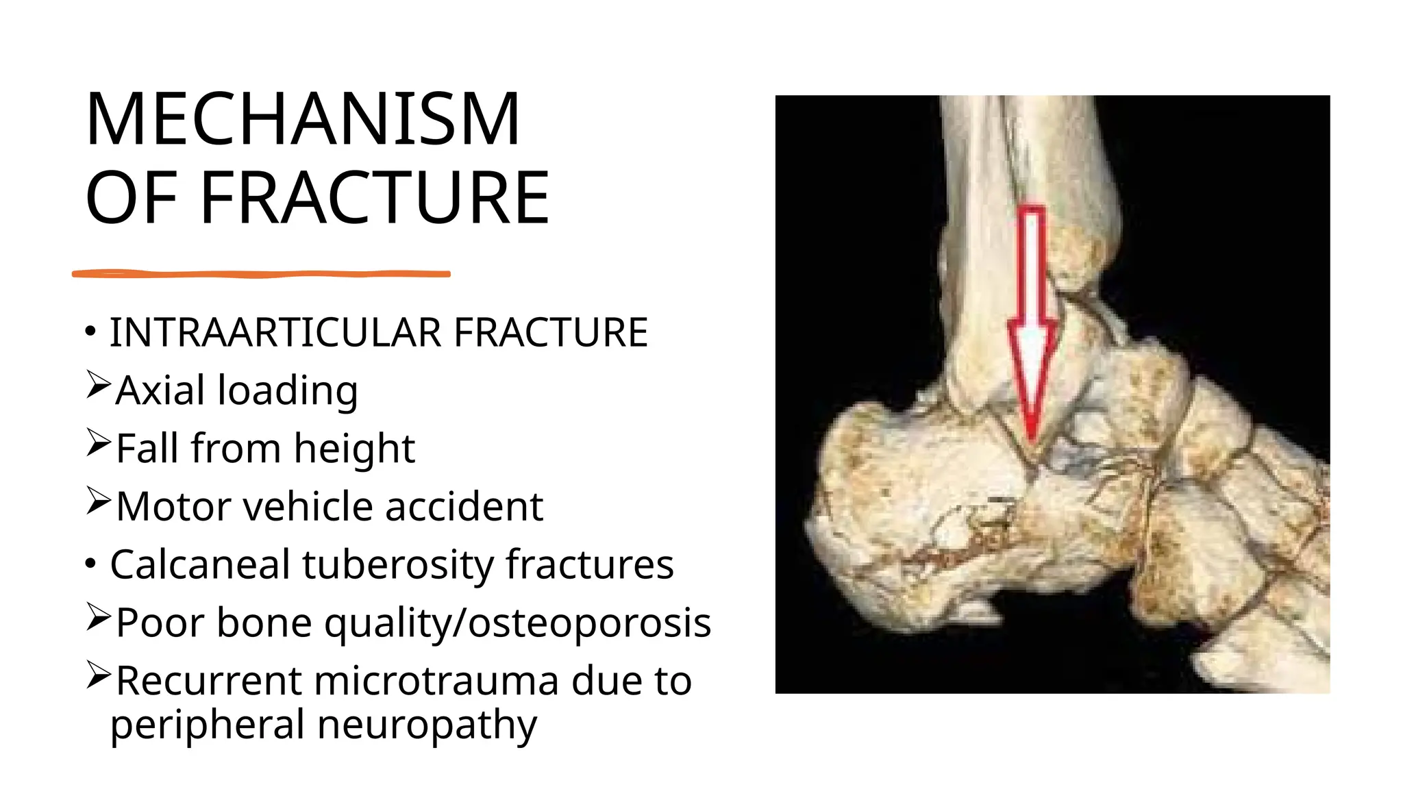 calcaneal fracture presentation pptx.ppt