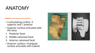 calcaneal fracture presentation pptx.ppt