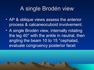 Calcaneal fractures new | PPT