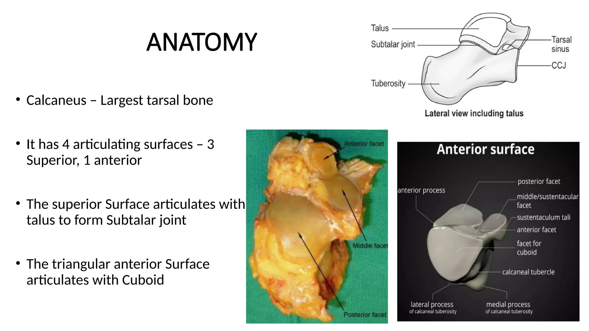 CALCANEAL FRACTURES PPT and JOURNAL.pptx