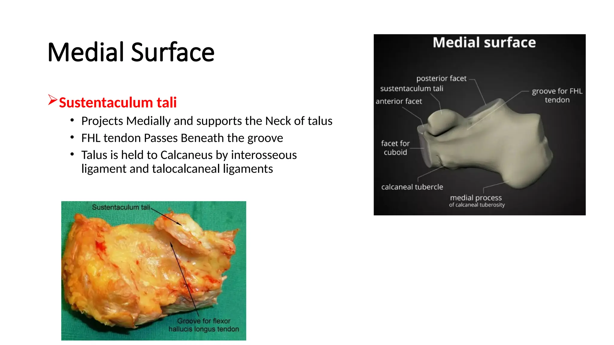 CALCANEAL FRACTURES PPT and JOURNAL.pptx