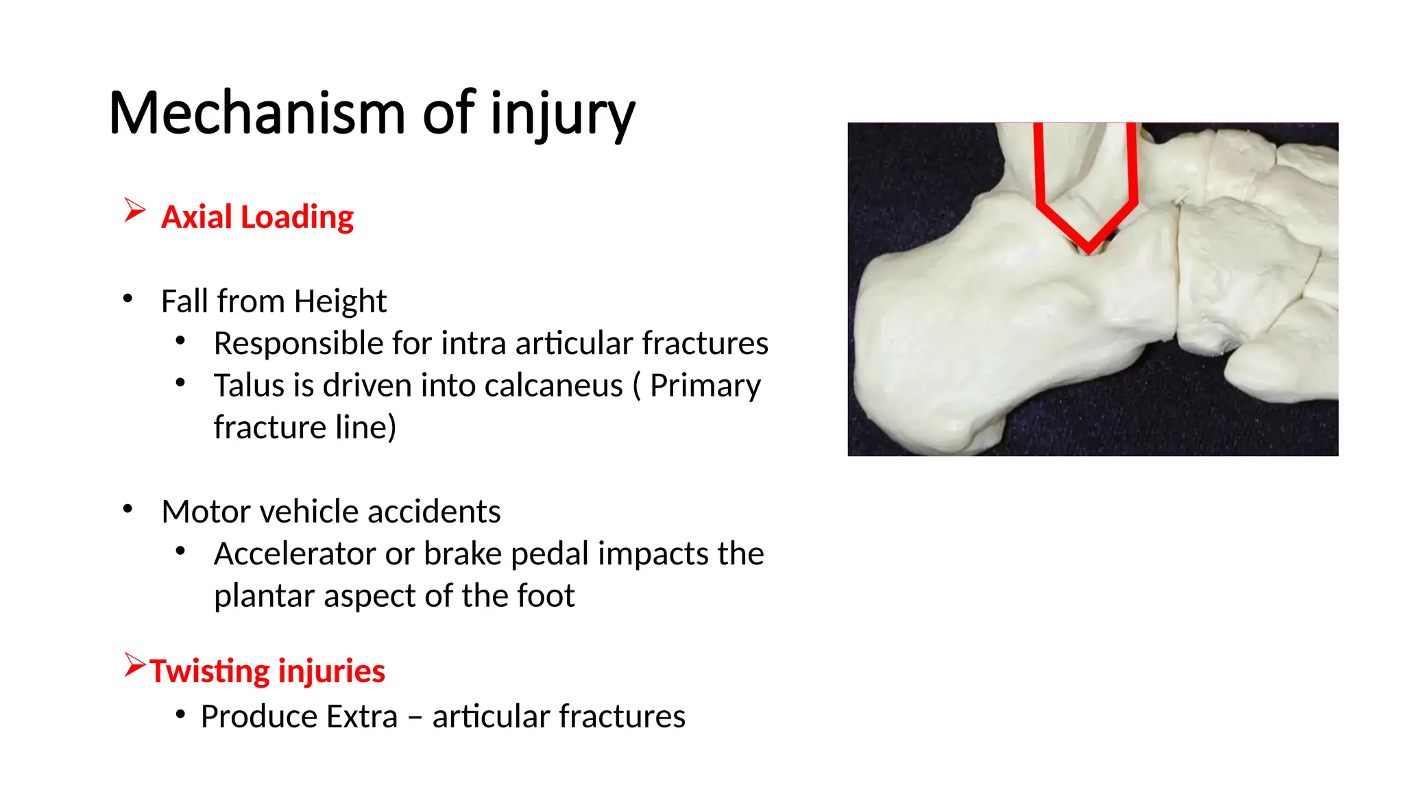 CALCANEAL FRACTURES PPT and JOURNAL.pptx