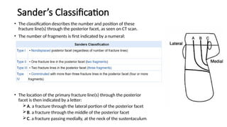 CALCANEAL FRACTURES PPT and JOURNAL.pptx