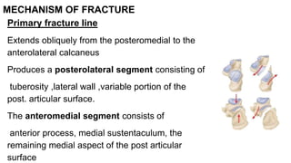 FRACTURES of CALCANEUS AND TALUS | PPTX