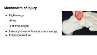 FRACTURES of CALCANEUS AND TALUS | PPTX