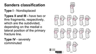 FRACTURES of CALCANEUS AND TALUS | PPT
