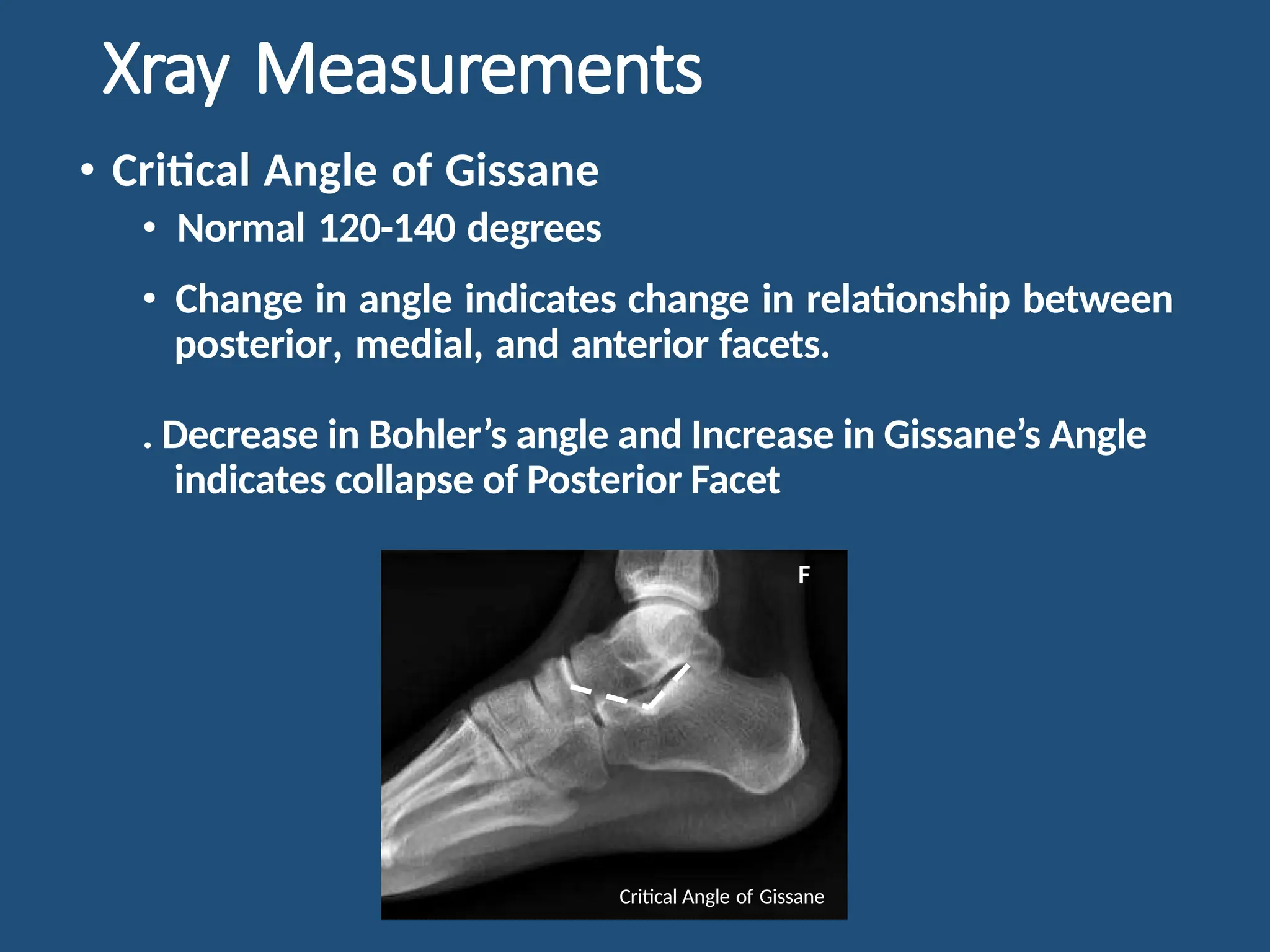 Calcaneum types and management in details l.pptx
