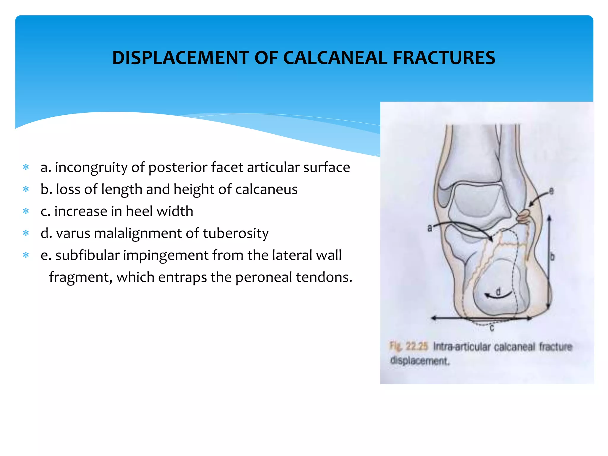 CALCANEUM FRACTURES.pptx