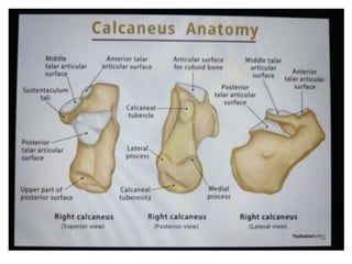 CALCANEUM FRACTURES.pptx