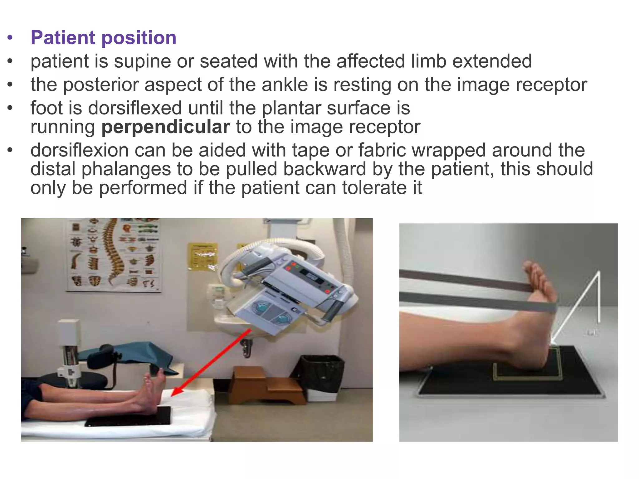Calcaneum radiographic views | PPTX