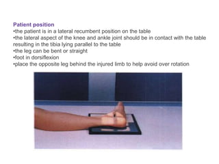 Calcaneum radiographic views | PPTX
