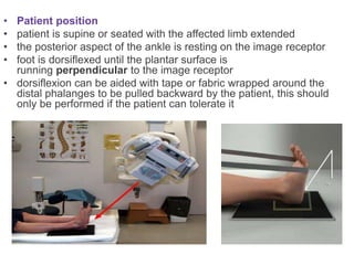 Calcaneum radiographic views | PPTX