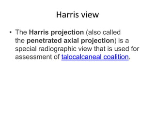 Calcaneum radiographic views | PPTX