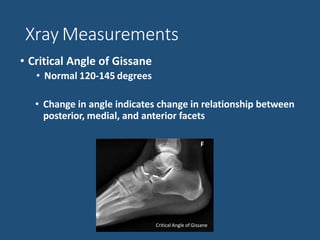 Calcaneus fracture | PPTX