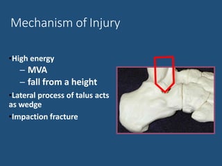 Calcaneus fracture | PPTX