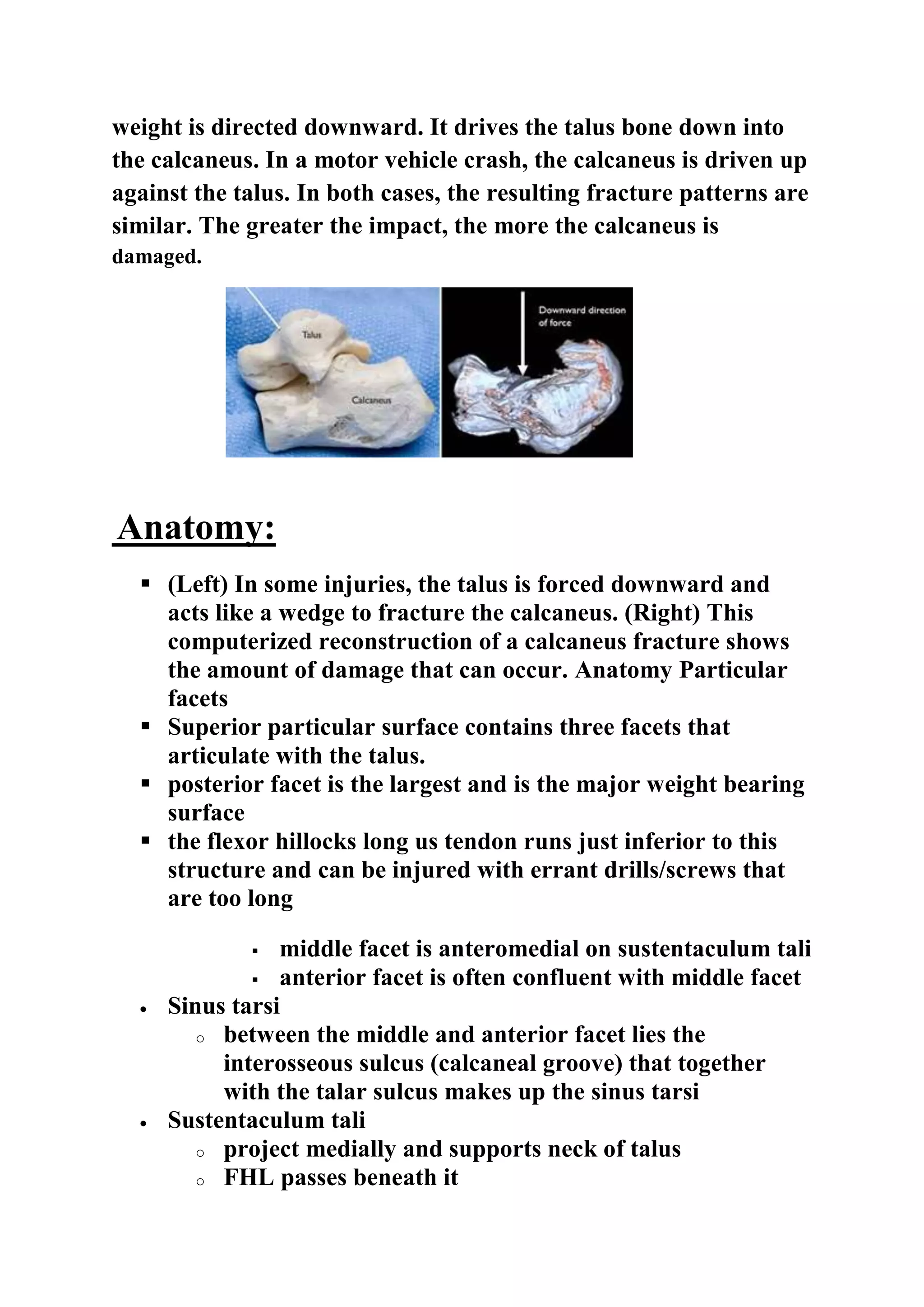 Calcaneus fracture | DOCX