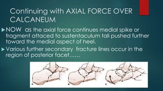 Calcaneus fractures by dr sidhu | PPTX
