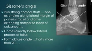 Calcaneus fractures by dr sidhu | PPT
