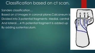 Calcaneus fractures by dr sidhu | PPTX