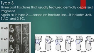Calcaneus fractures by dr sidhu | PPTX