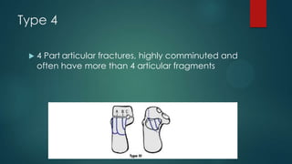 Calcaneus fractures by dr sidhu | PPTX