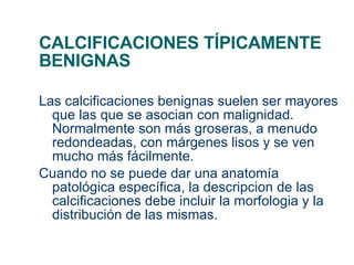 Calcificaciones TíPicamente Benignas | PPT