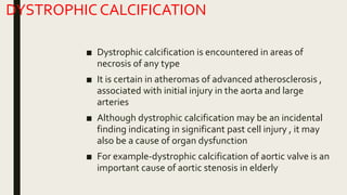 Pathologic Calcification | PPTX