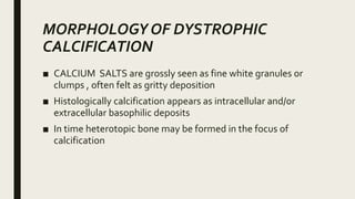 calcification-171003192519 2.pdf