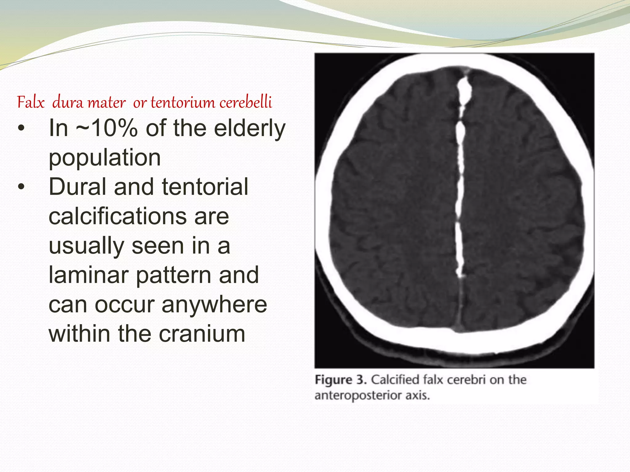 PHYSIOLOGICAL AND PATHOLOGICAL CALCIFICATION OF BRAIN | PPTX