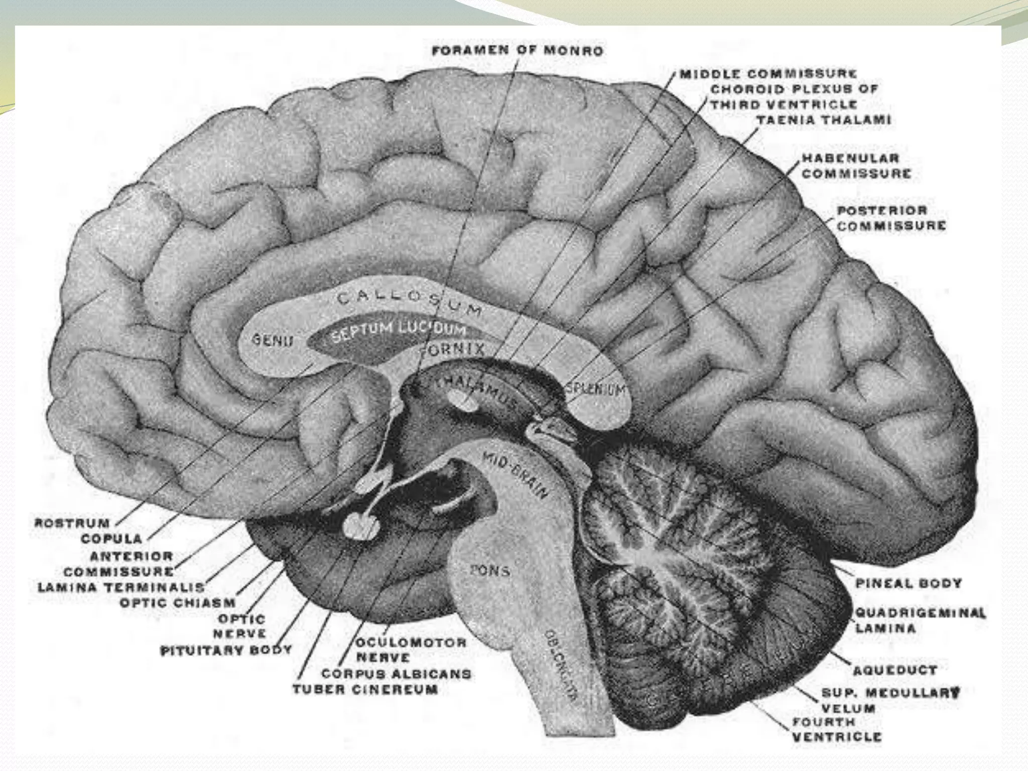 Physiological And Pathological Calcification Of Brain Ppt