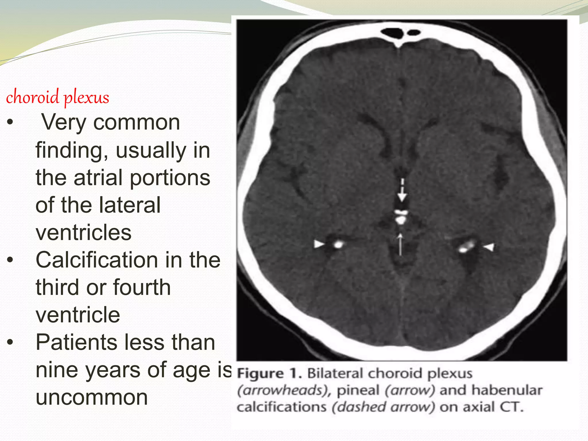 PHYSIOLOGICAL AND PATHOLOGICAL CALCIFICATION OF BRAIN | PPTX
