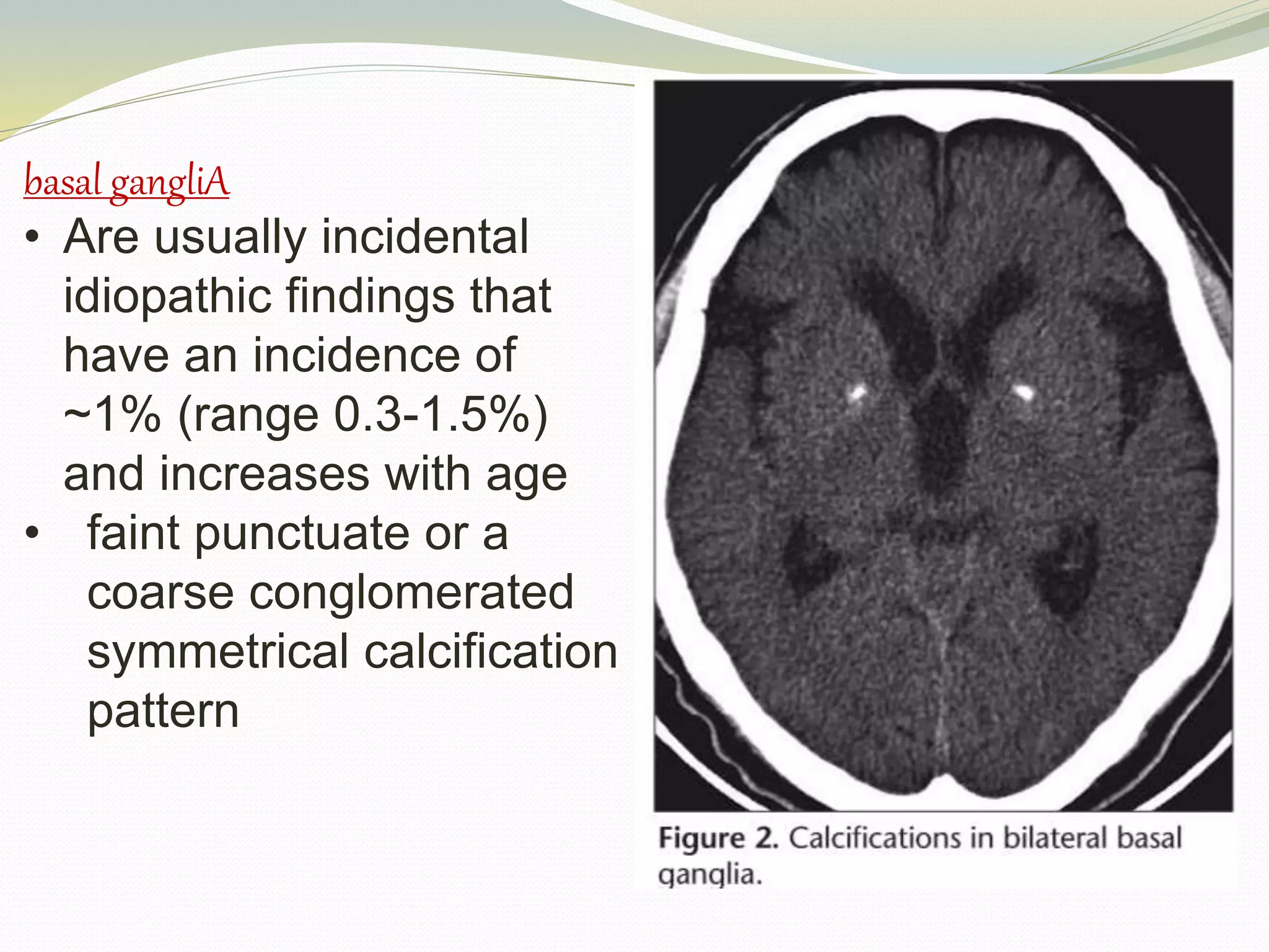 PHYSIOLOGICAL AND PATHOLOGICAL CALCIFICATION OF BRAIN | PPTX