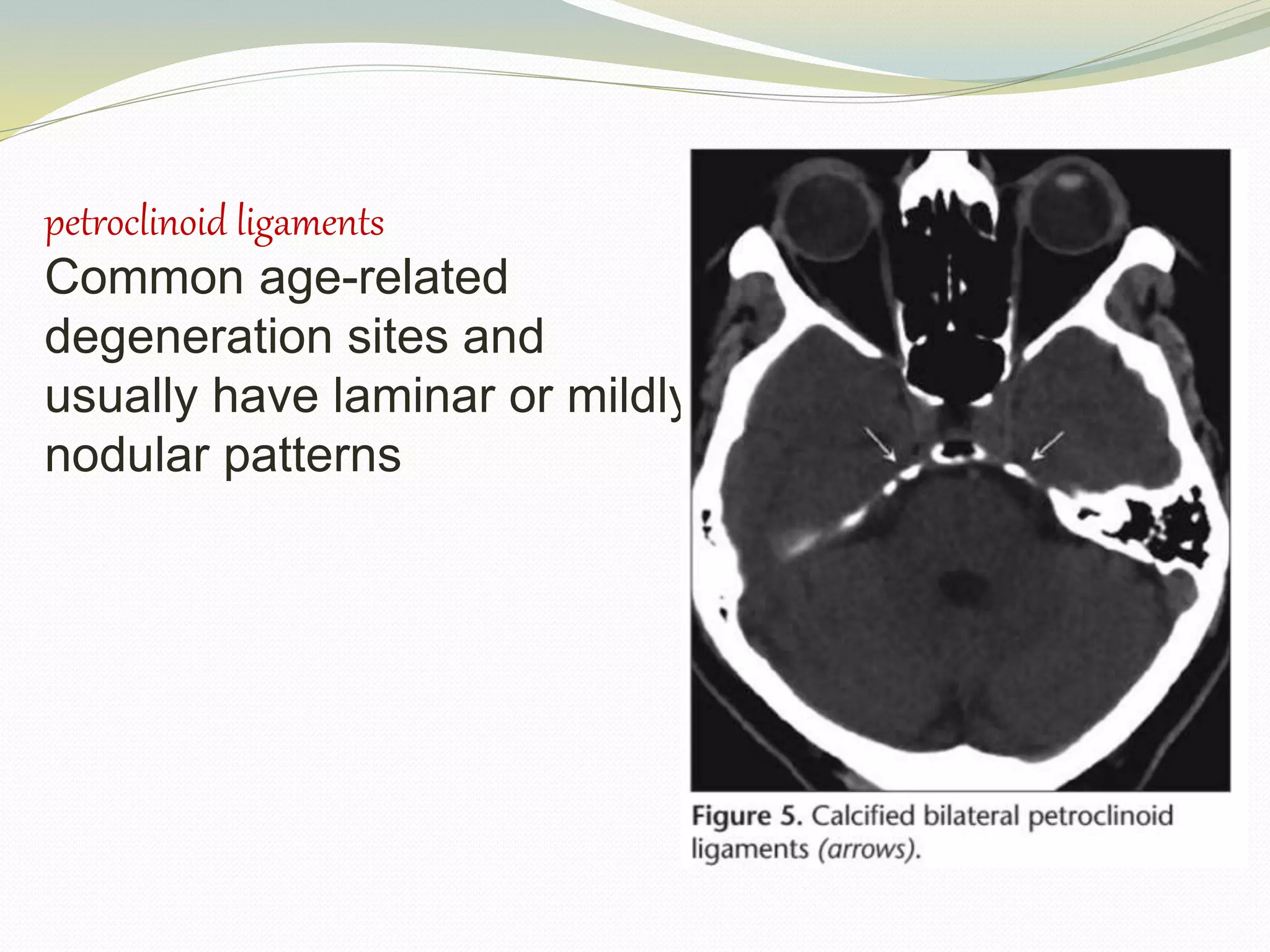 PHYSIOLOGICAL AND PATHOLOGICAL CALCIFICATION OF BRAIN | PPTX