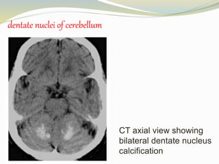 PHYSIOLOGICAL AND PATHOLOGICAL CALCIFICATION OF BRAIN | PPTX